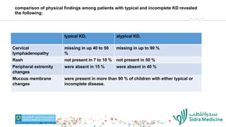 atypical kawasaki disease by dr ibrahim zal | PPT