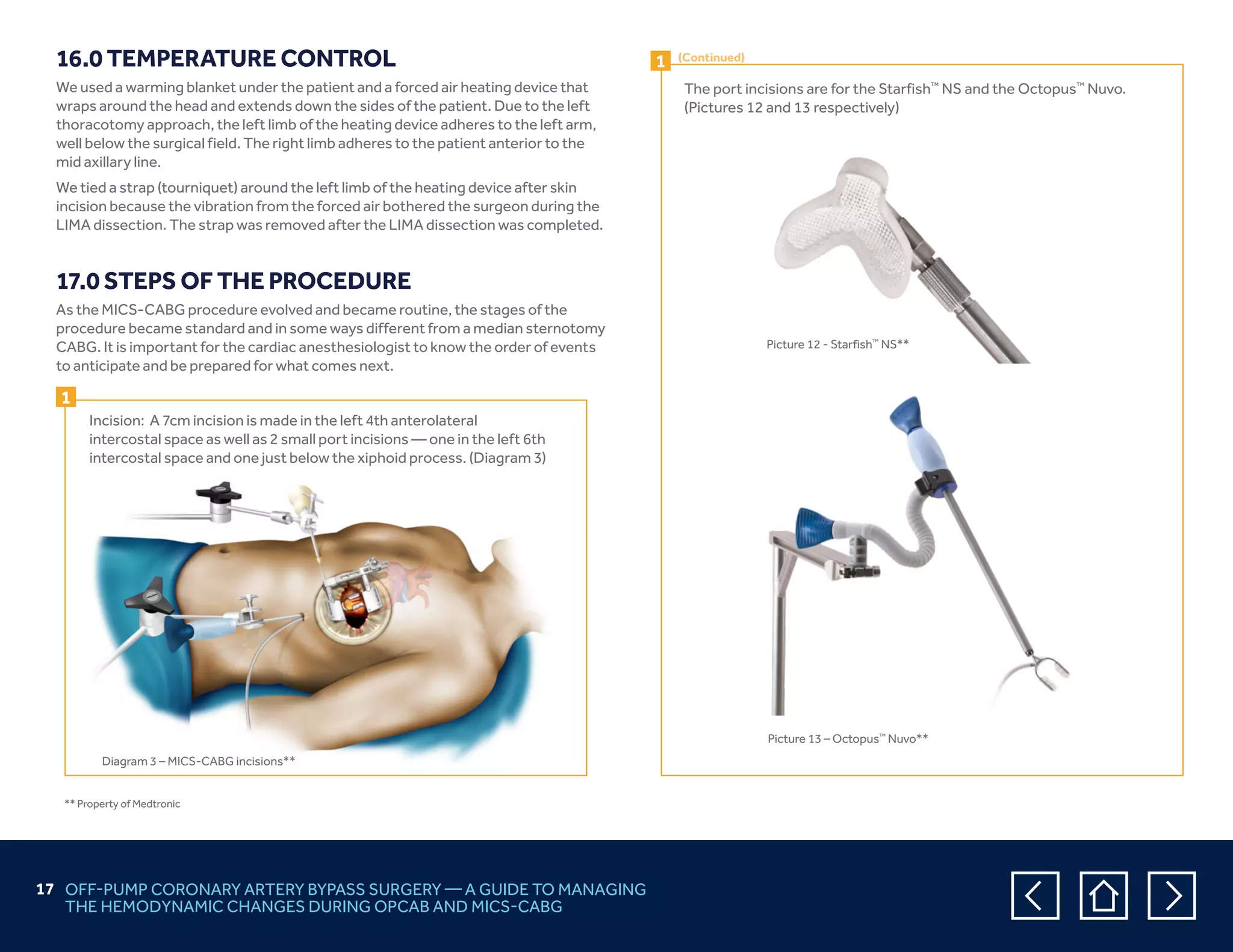 OFF-PUMP CORONARY ARTERY BYPASS SURGERY A GUIDE TO MANAGING THE ...