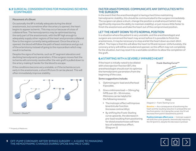OFF-PUMP CORONARY ARTERY BYPASS SURGERY A GUIDE TO MANAGING THE ...