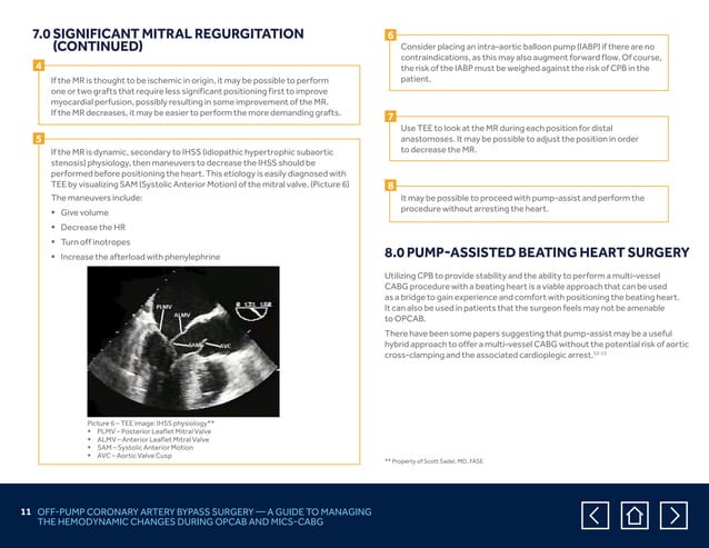 OFF-PUMP CORONARY ARTERY BYPASS SURGERY A GUIDE TO MANAGING THE ...