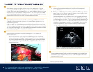 OFF-PUMP CORONARY ARTERY BYPASS SURGERY A GUIDE TO MANAGING THE ...