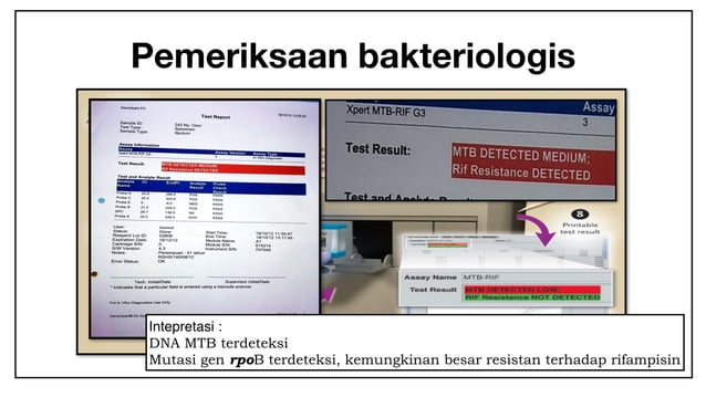 Diagnosis dan Tatalaksana TB Sensitif Obat | PDF
