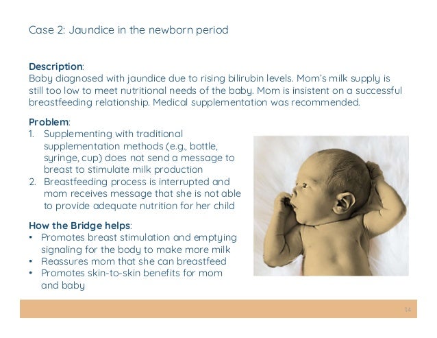 Introduction to the "Bridge" - a new breastfeeding support tool