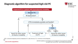 2019 Acute Pulmonary Embolism.pdf, escardio guideline | PDF