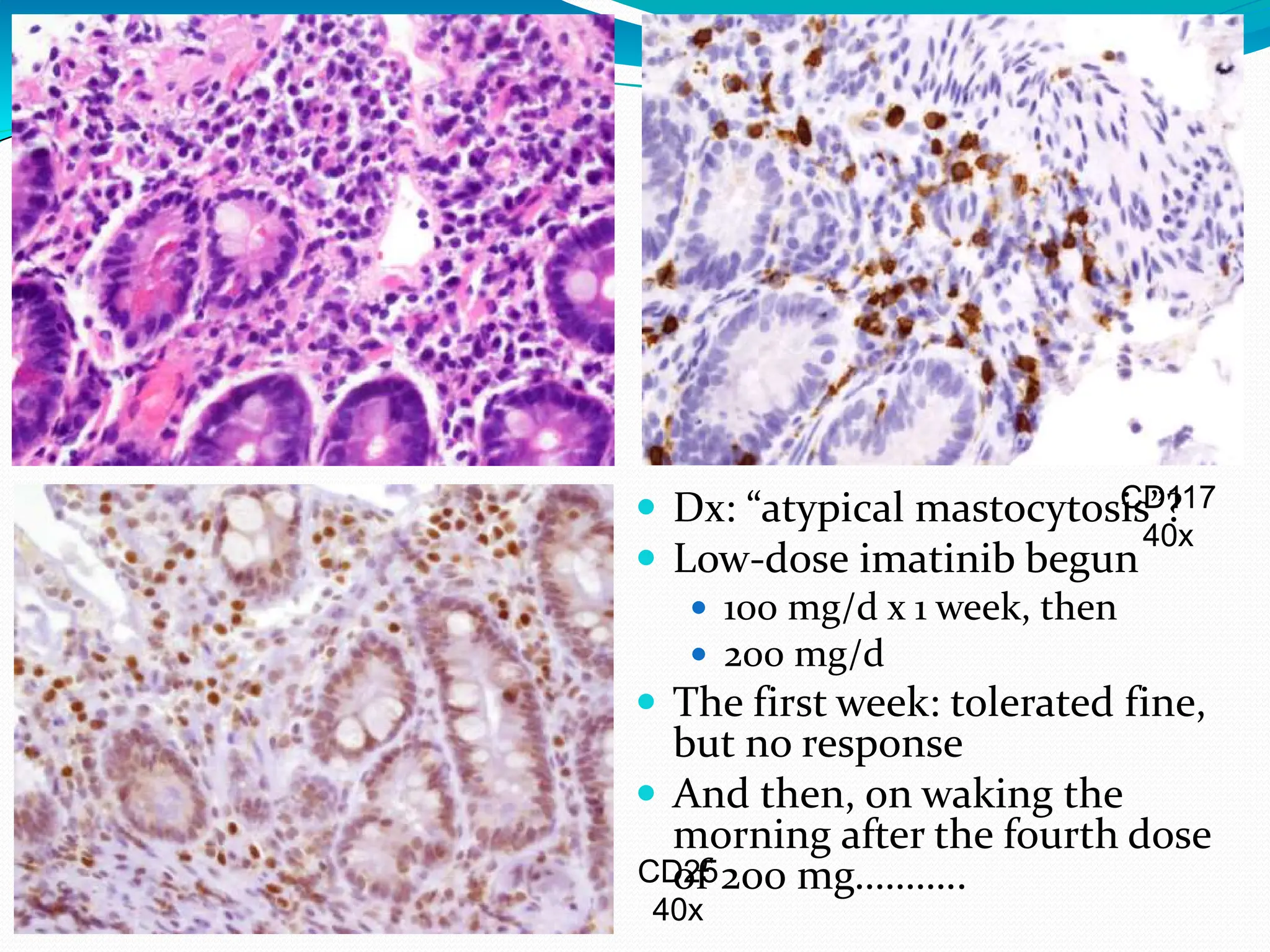 2019 Afrin Mast Cell Activation Syndrome.pdf