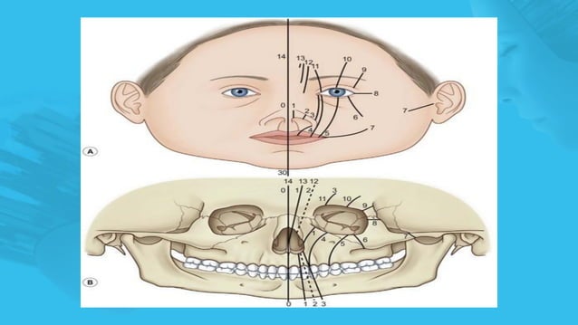Slide Cleft Lip and Palate | PDF