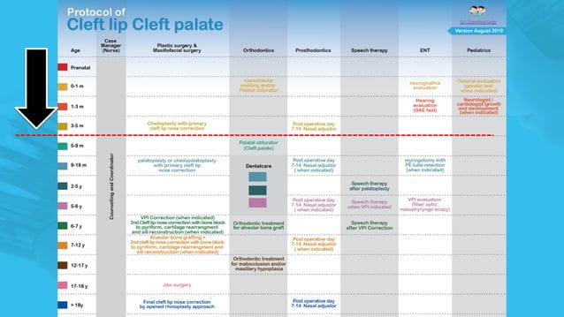 Slide Cleft Lip and Palate | PDF