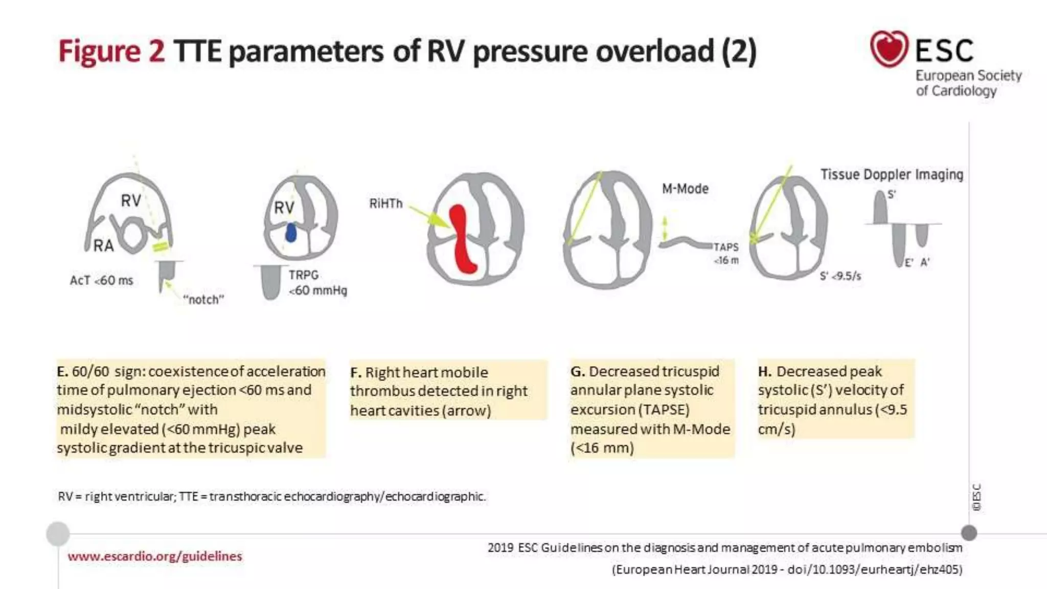 2019 ESC guidelines for pulmonary embolism | PPTX