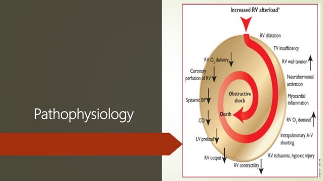 2019 ESC guidelines for pulmonary embolism | PPTX | Heart and ...