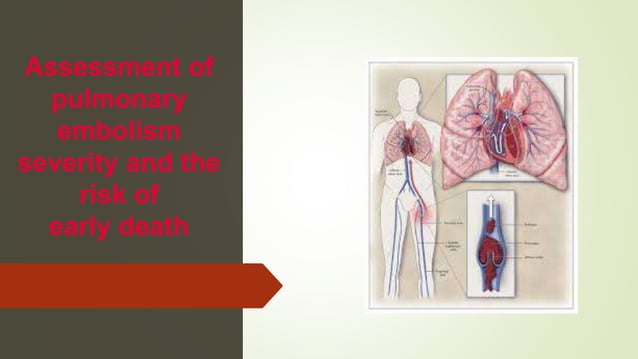 2019 ESC guidelines for pulmonary embolism | PPTX | Heart and ...
