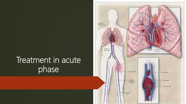 2019 ESC guidelines for pulmonary embolism | PPTX | Heart and ...