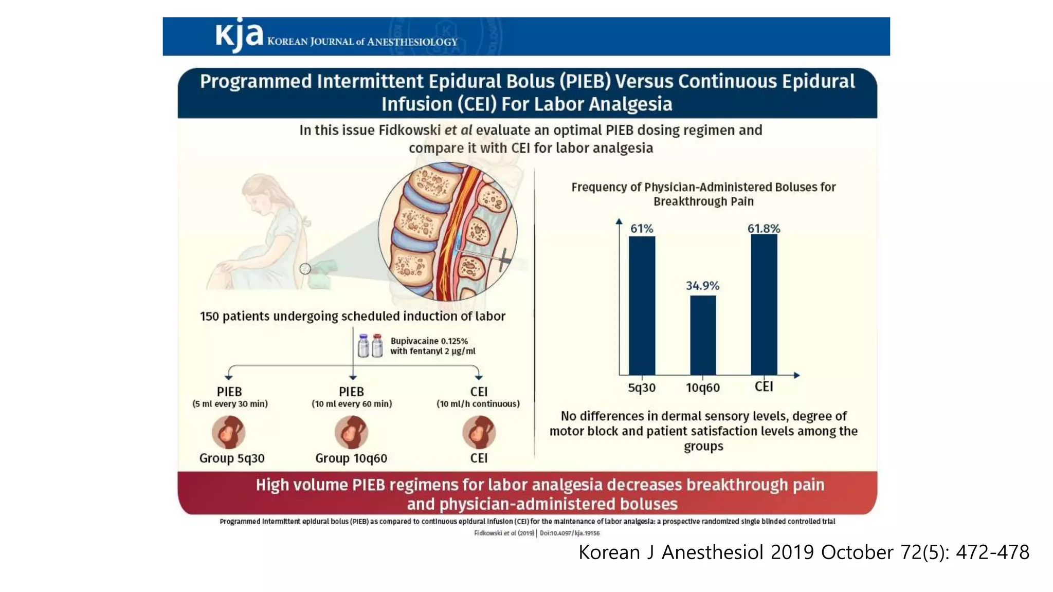 2019 kps update of epidural PCA | PPTX