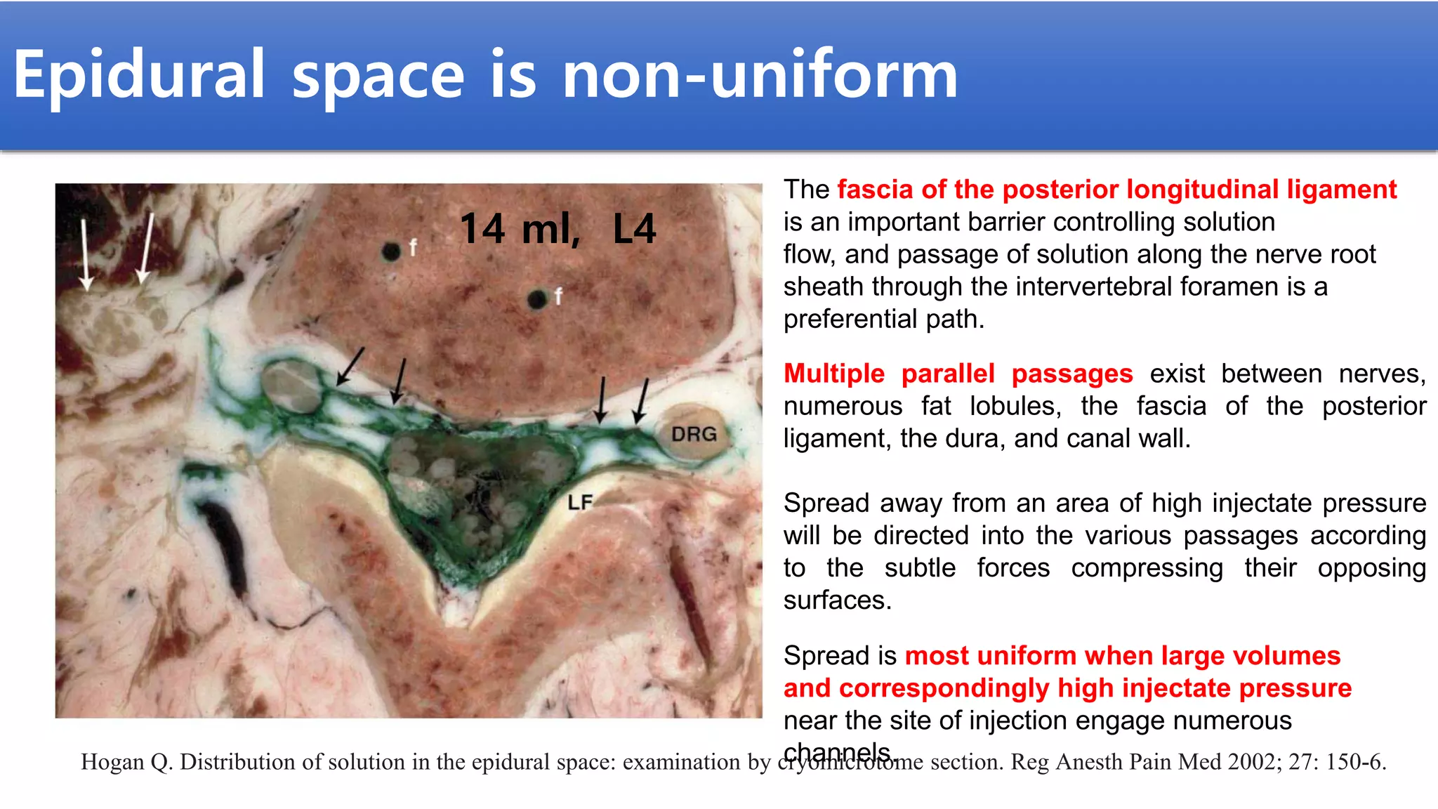 2019 kps update of epidural PCA | PPTX