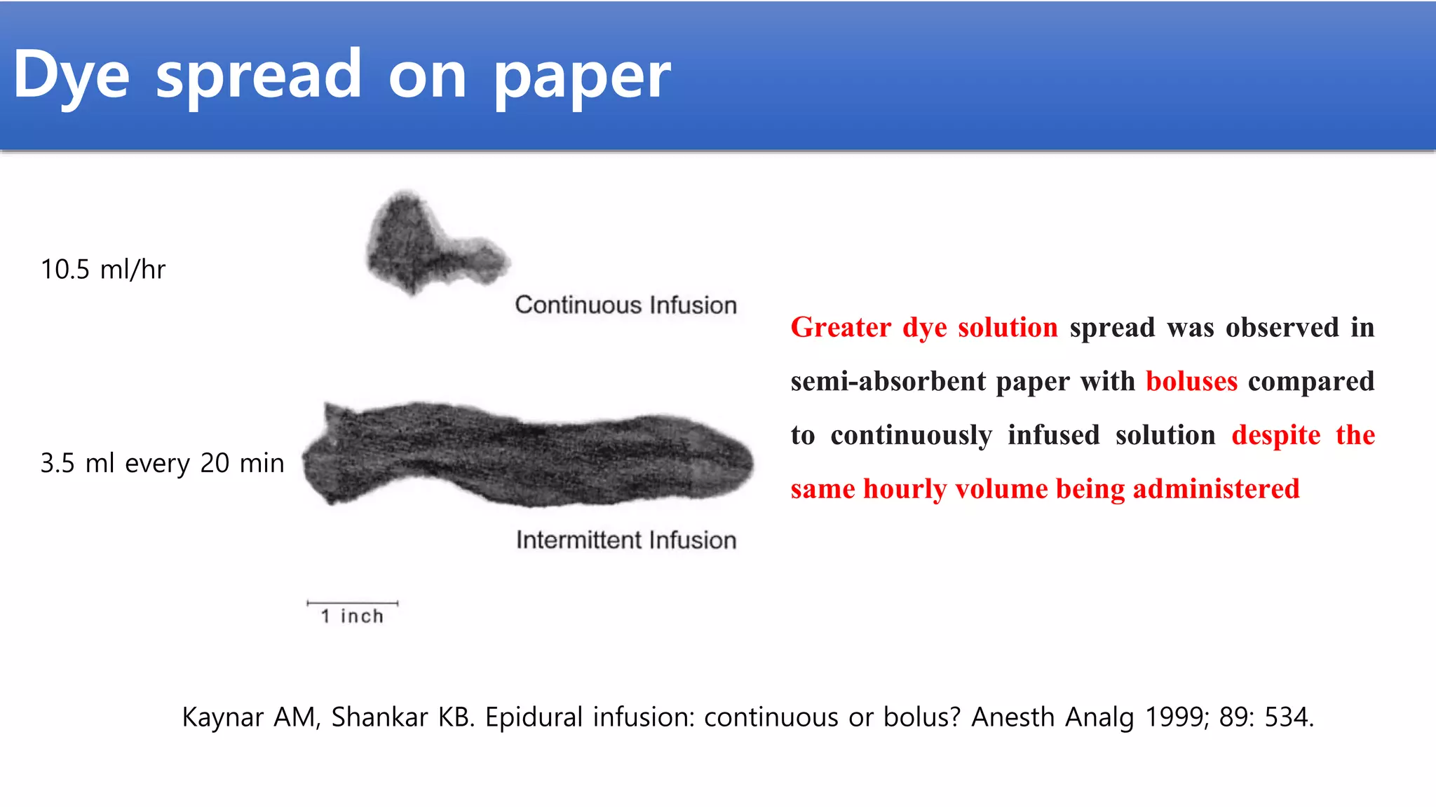 2019 kps update of epidural PCA | PPTX