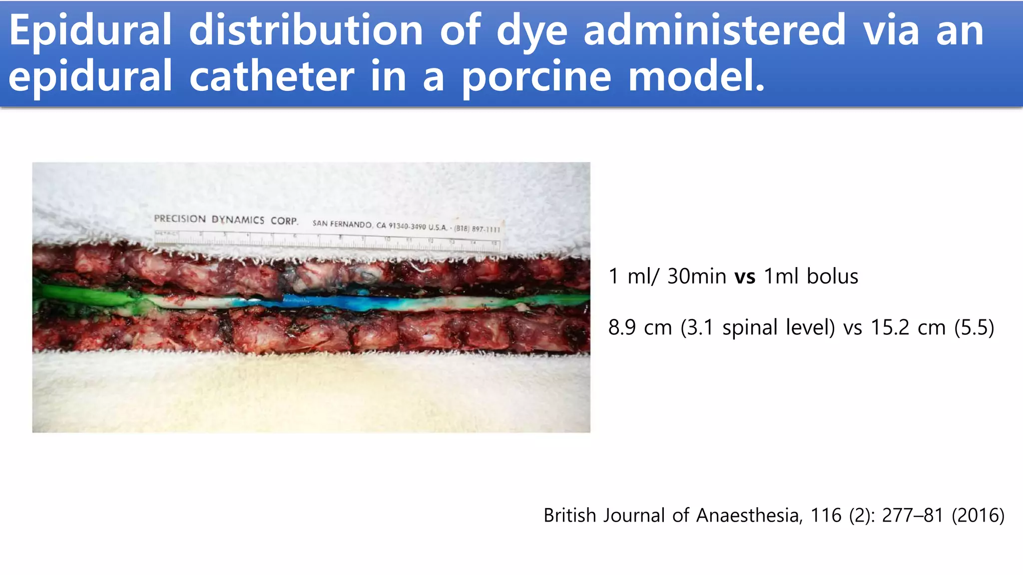 2019 kps update of epidural PCA | PPTX