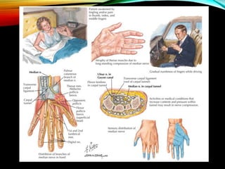 Nerve entrapment & injury for medical student (2ed) | PPTX