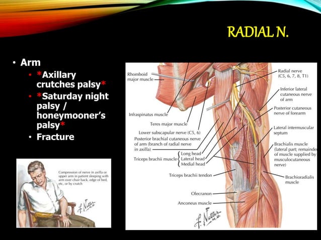 Nerve entrapment & injury for medical student (2ed) | PPTX | Death ...
