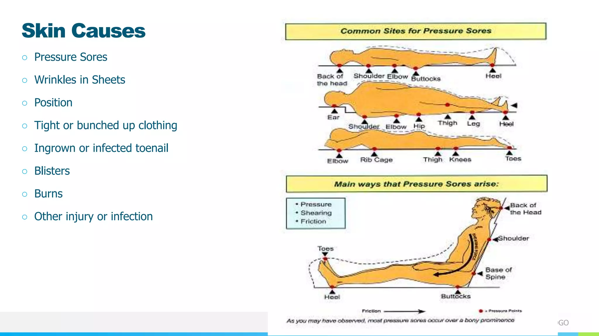 2019 autonomic dysreflexia | PPTX