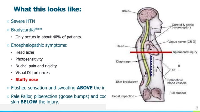2019 autonomic dysreflexia | PPTX | Brain and Nervous System Disorders ...