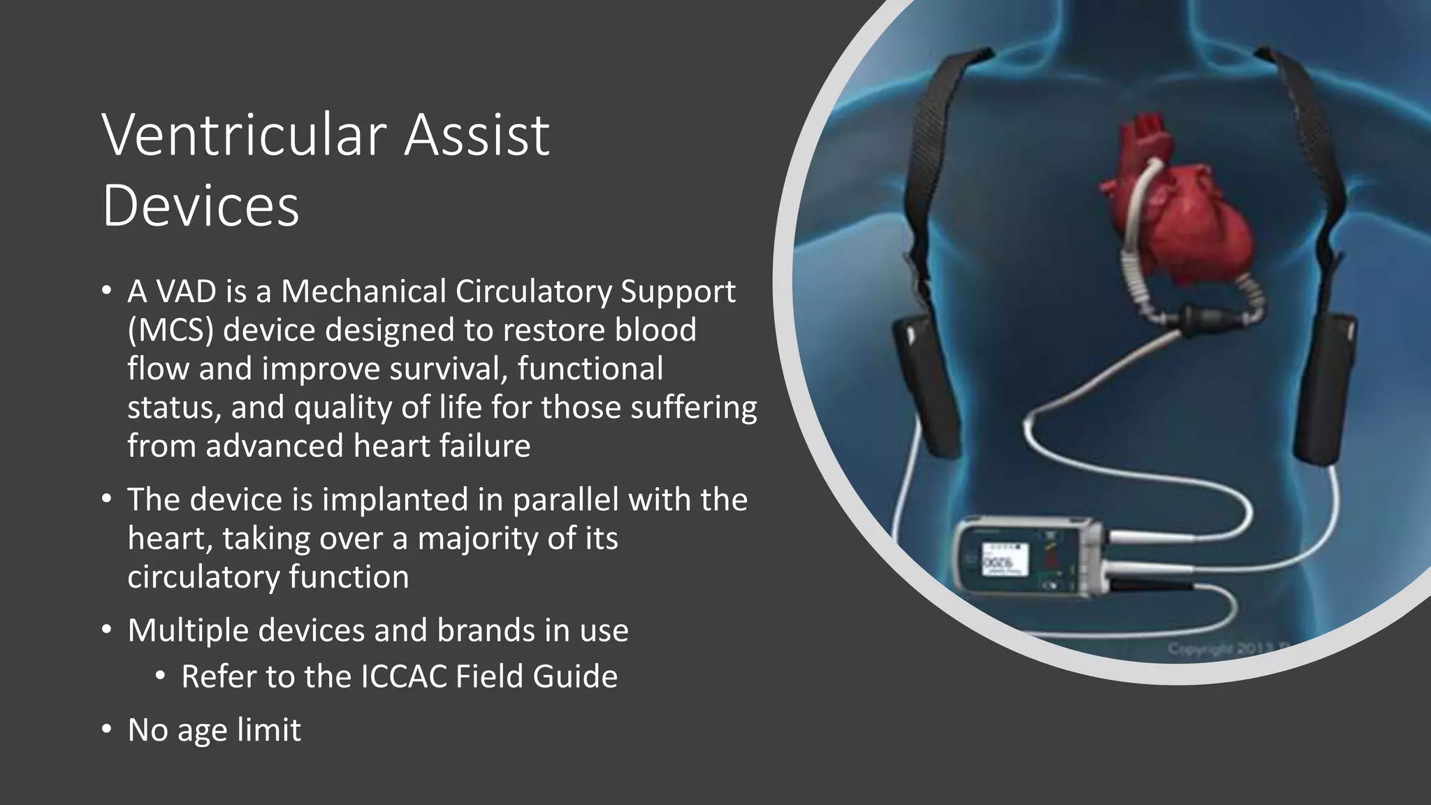 2019 parm 2223 mod 8 circulatory assist devices | PPTX