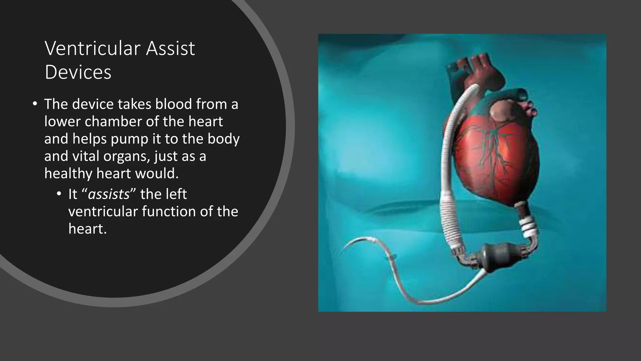 2019 parm 2223 mod 8 circulatory assist devices | PPTX