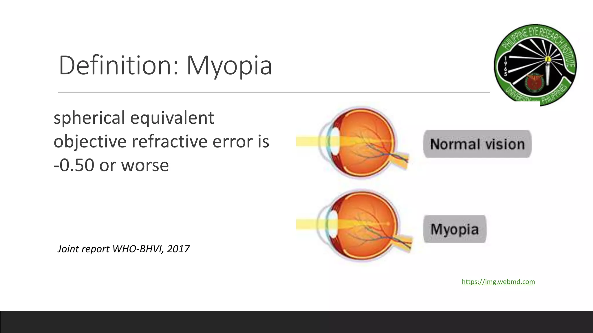 Myopia: Risk Factor for Ocular Morbidity and Permanent Visual Loss | PPTX
