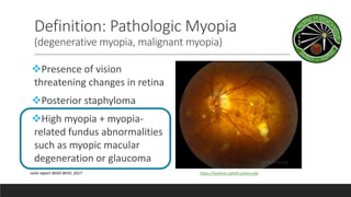 Myopia: Risk Factor for Ocular Morbidity and Permanent Visual Loss | PPTX