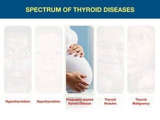 2019-5-22 PTA - Philippine Thyroid Summit | PDF