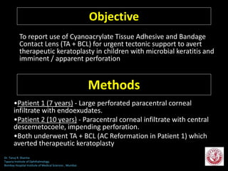 Tissue Adhesive + Bcl In Childrenwith Microbial Keratitis | PPTX