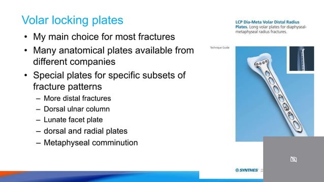 High Energy Distal Radius Fractures - External fixation, Bridge plating ...
