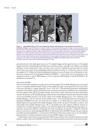 2020-Clinical characteristics of Alexander disease.pdf
