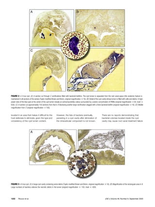 2020 true-versus-bay-apical-cysts-clinical-radiographic ...