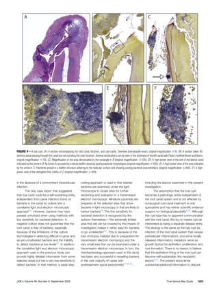 2020 true-versus-bay-apical-cysts-clinical-radiographic ...