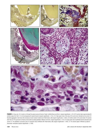 2020 true-versus-bay-apical-cysts-clinical-radiographic ...