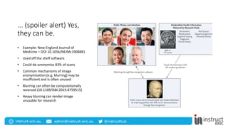 MRI Face De-anonymisation use case | PPT