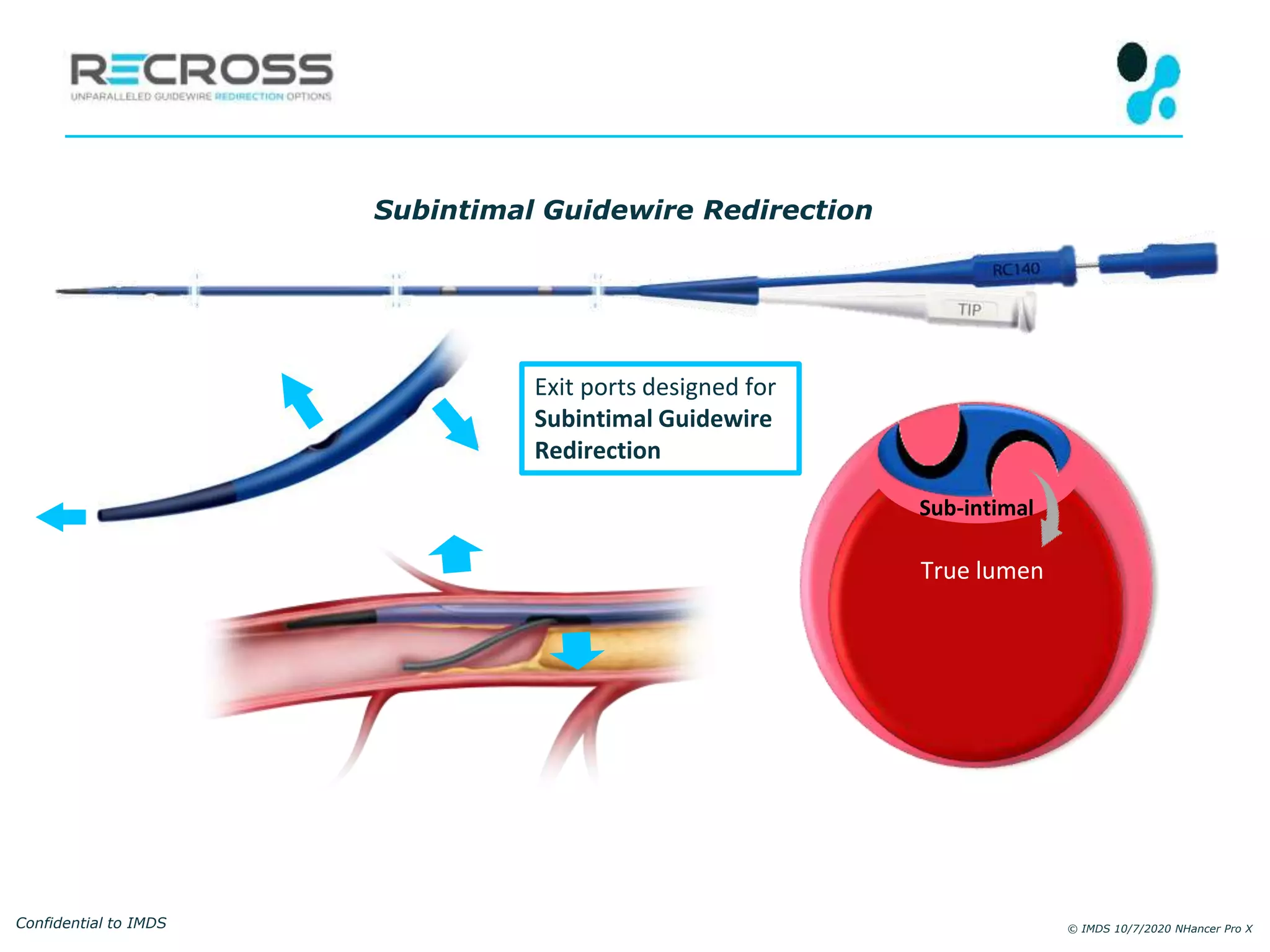 Session 3 - Microcatheters, new developments | PPTX