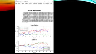 FMRI_DATA_ANALYSIS_REPORT_AND_PREPROCESSING_STEPS .pptx
