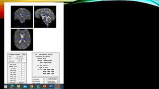 FMRI_DATA_ANALYSIS_REPORT_AND_PREPROCESSING_STEPS .pptx