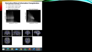 FMRI_DATA_ANALYSIS_REPORT_AND_PREPROCESSING_STEPS .pptx