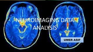 FMRI_DATA_ANALYSIS_REPORT_AND_PREPROCESSING_STEPS .pptx