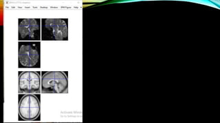 FMRI_DATA_ANALYSIS_REPORT_AND_PREPROCESSING_STEPS .pptx