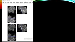 FMRI_DATA_ANALYSIS_REPORT_AND_PREPROCESSING_STEPS .pptx