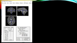 FMRI_DATA_ANALYSIS_REPORT_AND_PREPROCESSING_STEPS .pptx
