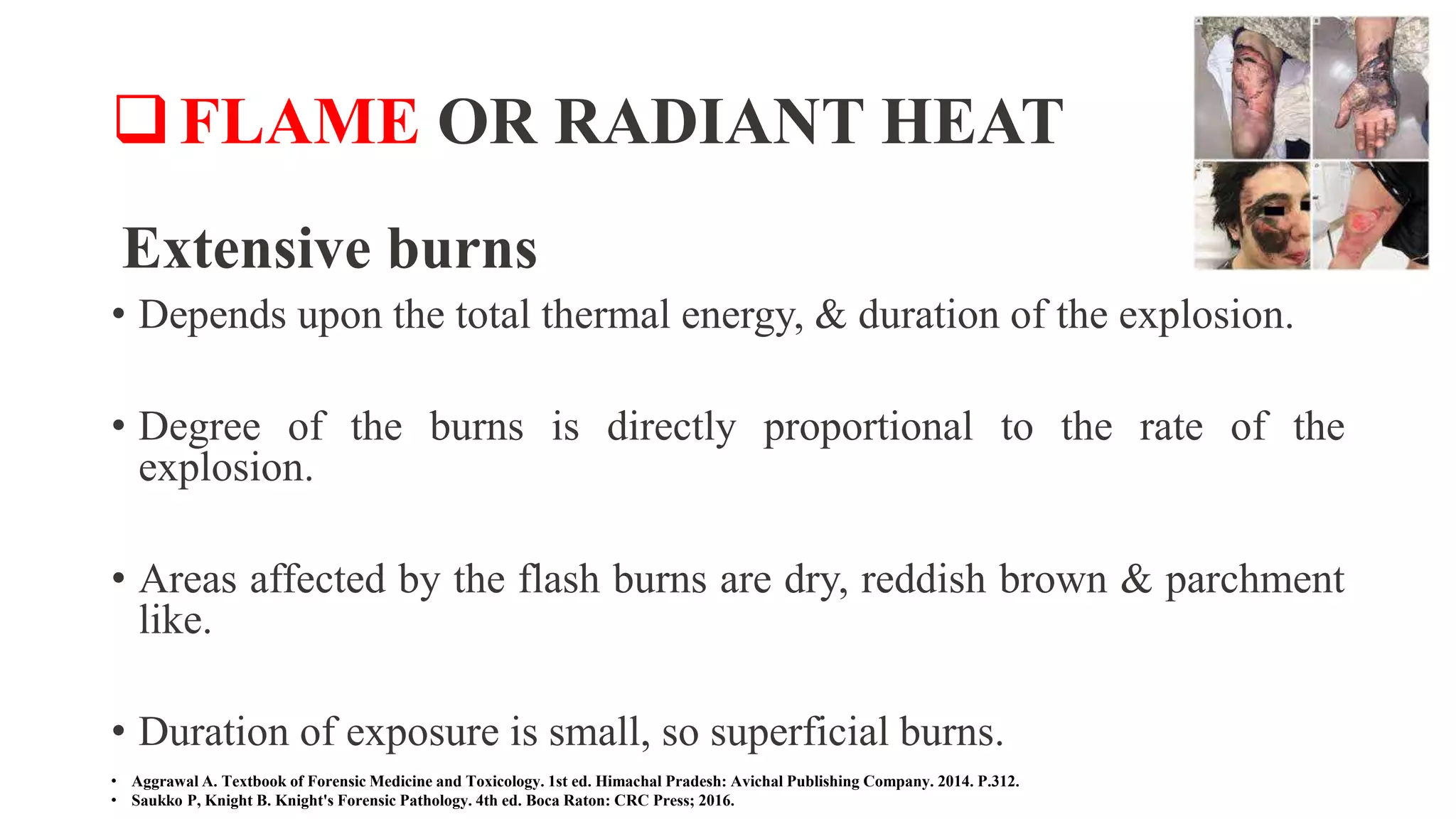 2021-Explosion Injuries-RP.pptx