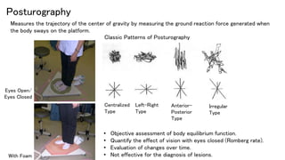 Diagnosis Support by Machine Learning Using Posturography Data | PPT