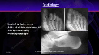 Updated summery 2021 American College of Rheumatology | PDF