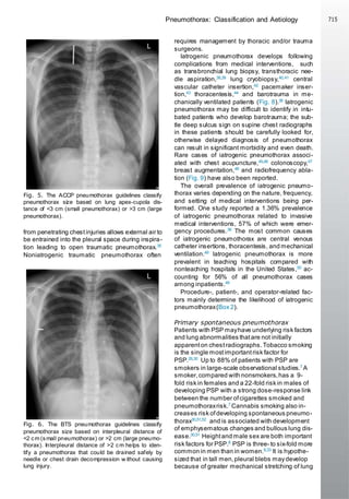 2021 clinchestmedpneumothoraxclassificationetiology convertido | PDF