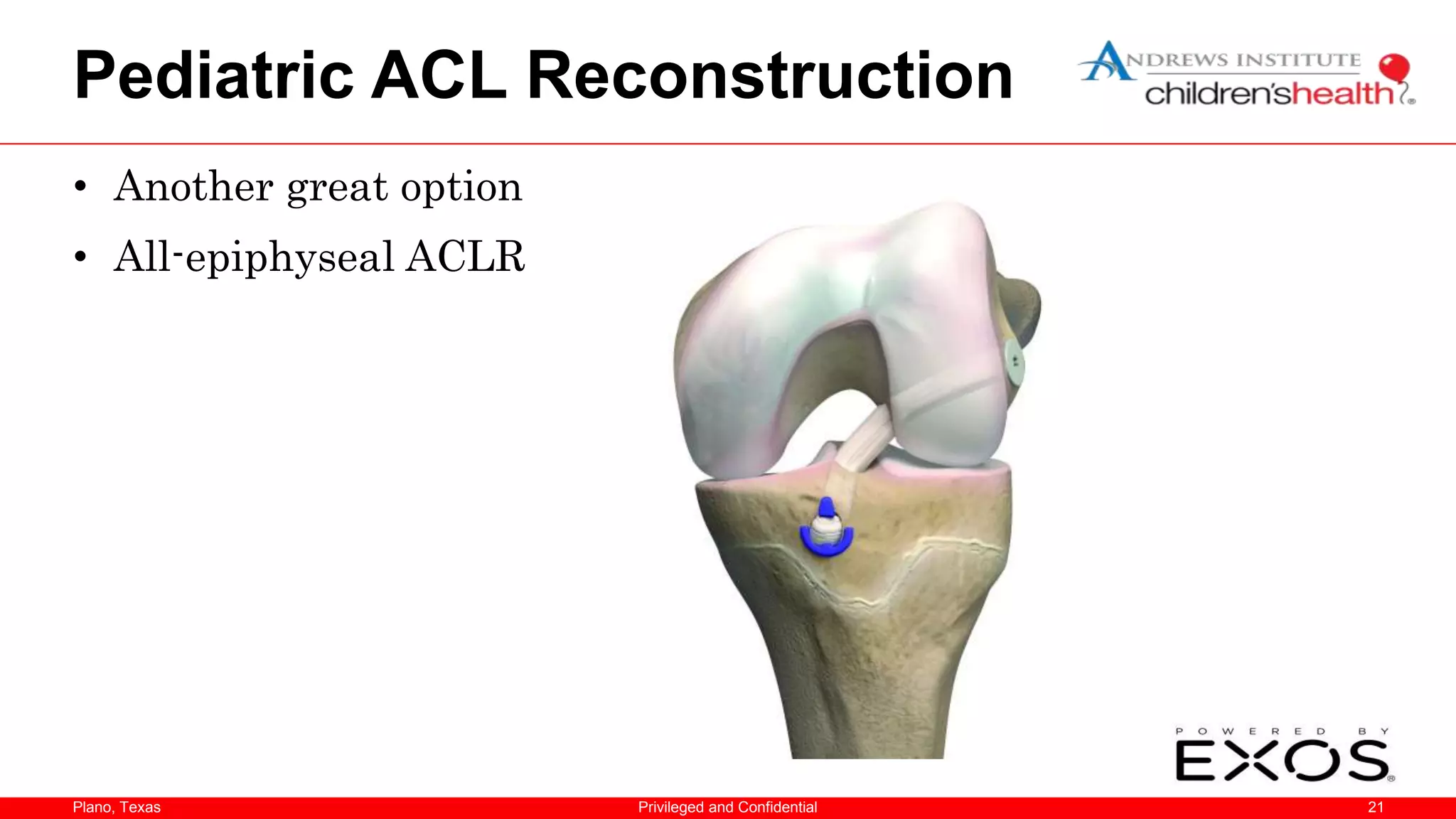 Pediatric ACL Injuries | PPTX