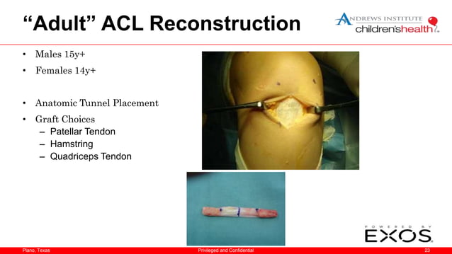 Pediatric ACL Injuries | PPTX