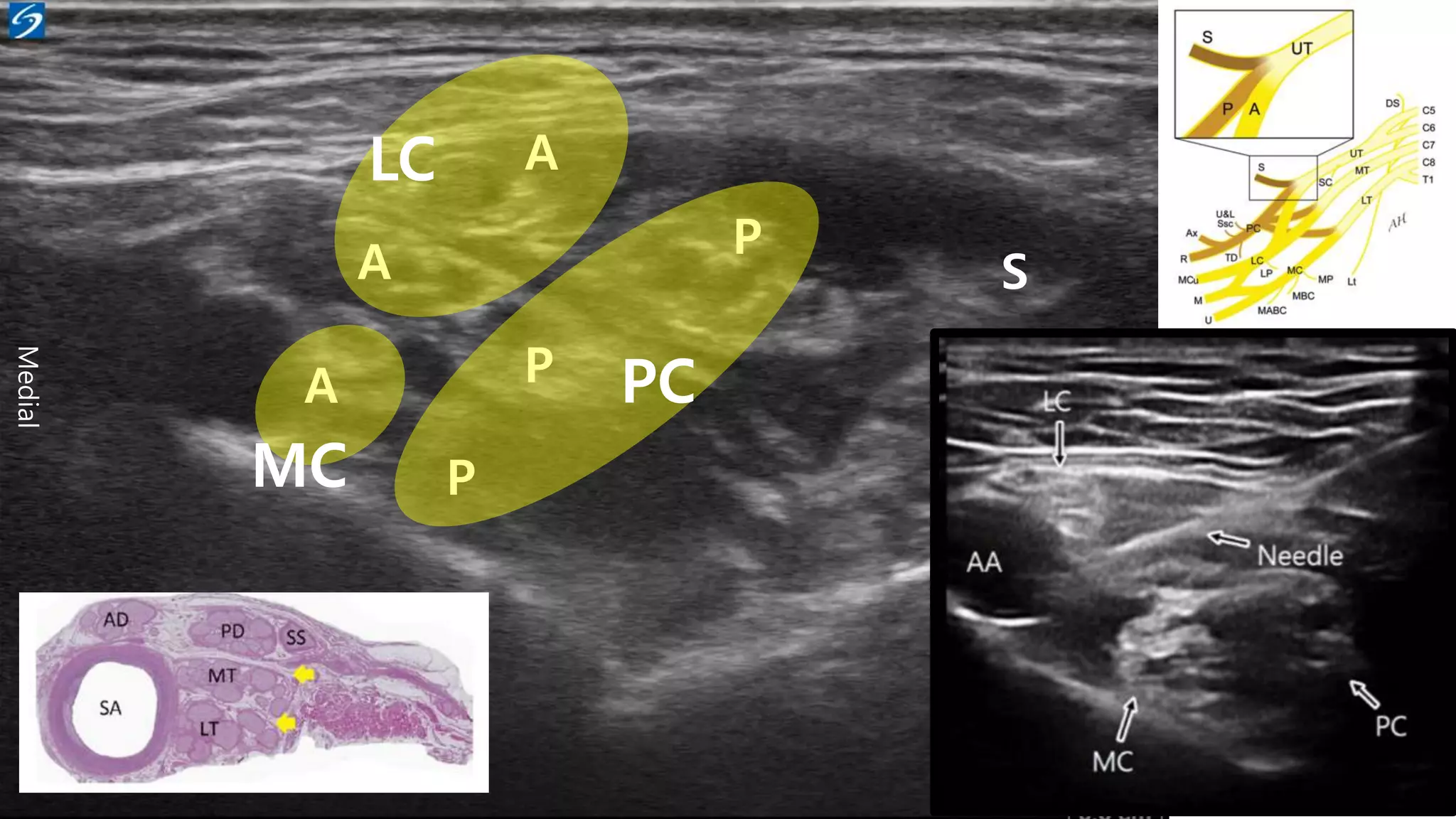 2021 KSRA clavicle innervation | PPTX